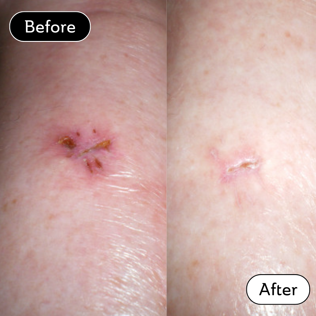 Sheila* - Scar – Science of Skin
